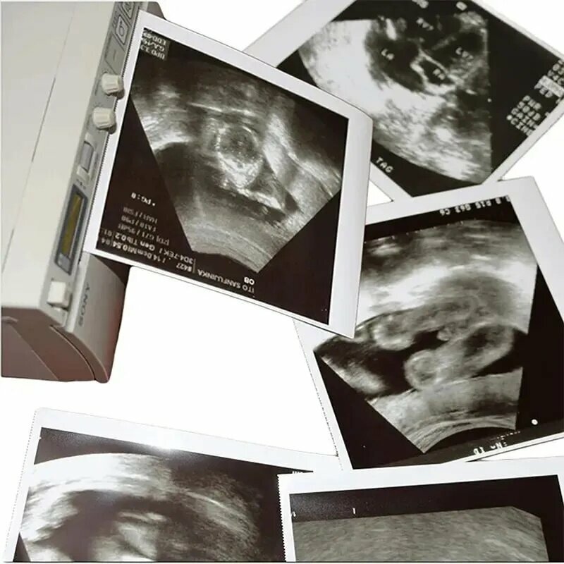 Термобумага Бумага для УЗИ Sony UPP-110HG 110 мм х 18 м