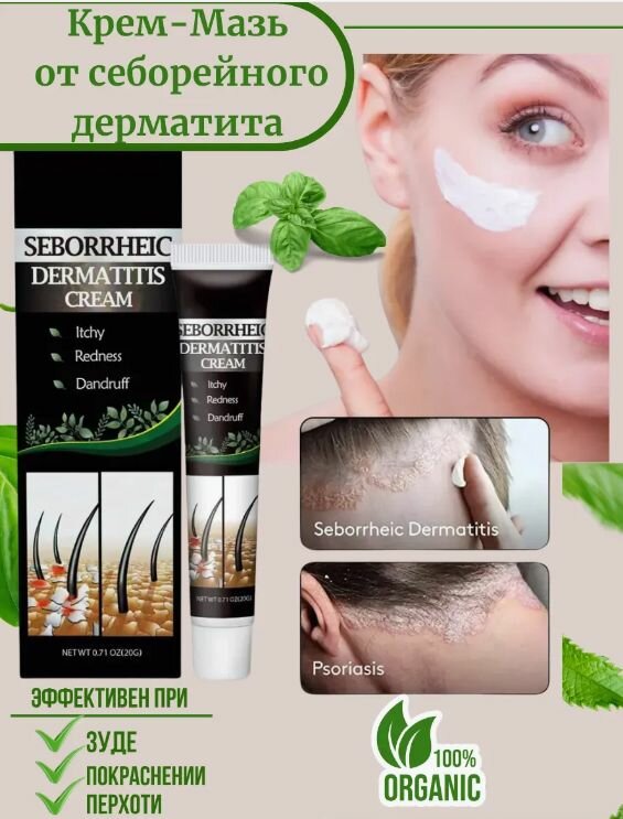 Мазь от атопического дерматита, 20 грамм, используется для лечения псориаза, себорейного дерматита и зуда кожи головы, эффективно устраняет перхоть, снимает воспаление и зуд