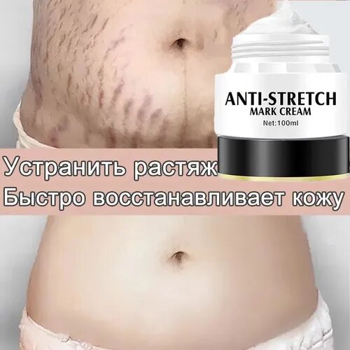 Средство от растяжек