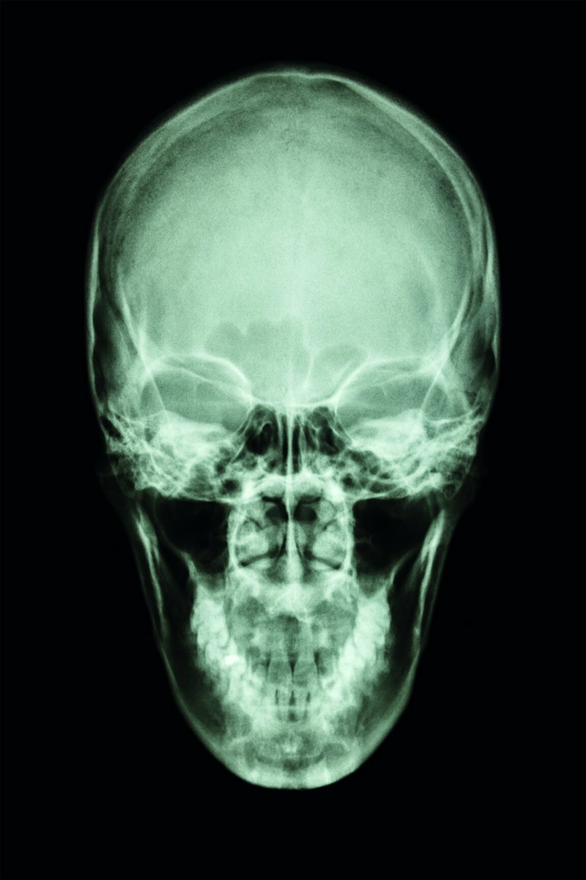 Постер / Плакат / Картина Череп 40х50 см в подарочном тубусе