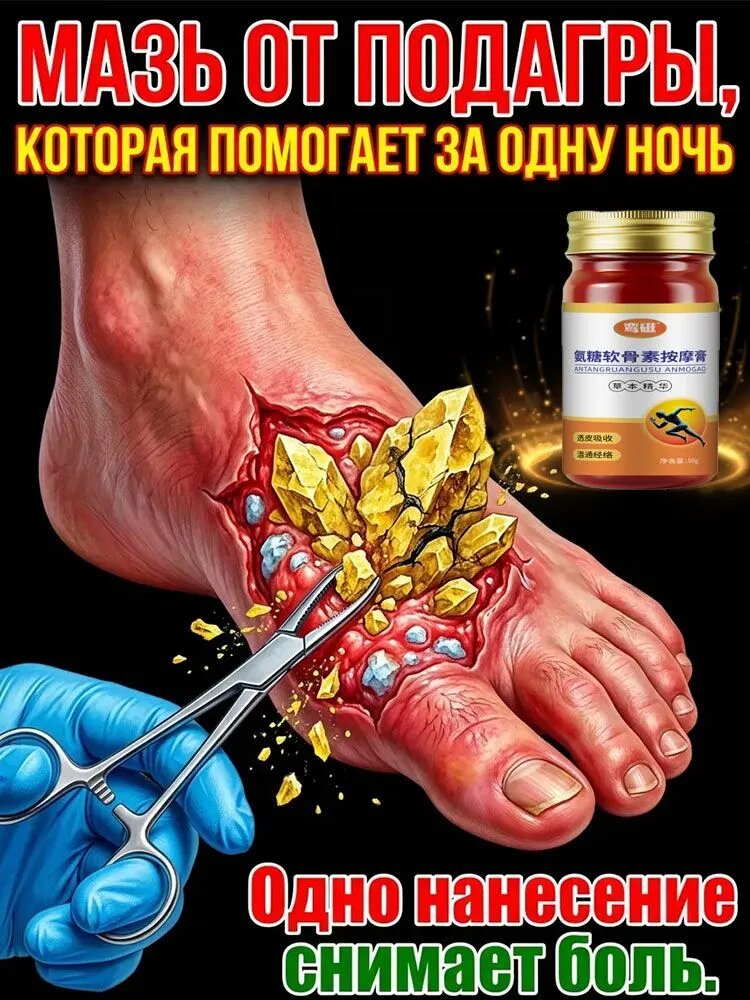 Мазь от подагры стопы, мазь от подагры на ноге и для рук и артрита