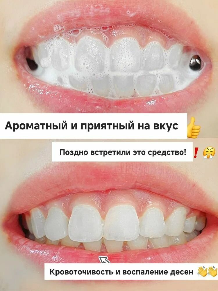 Зубная паста — фото 1