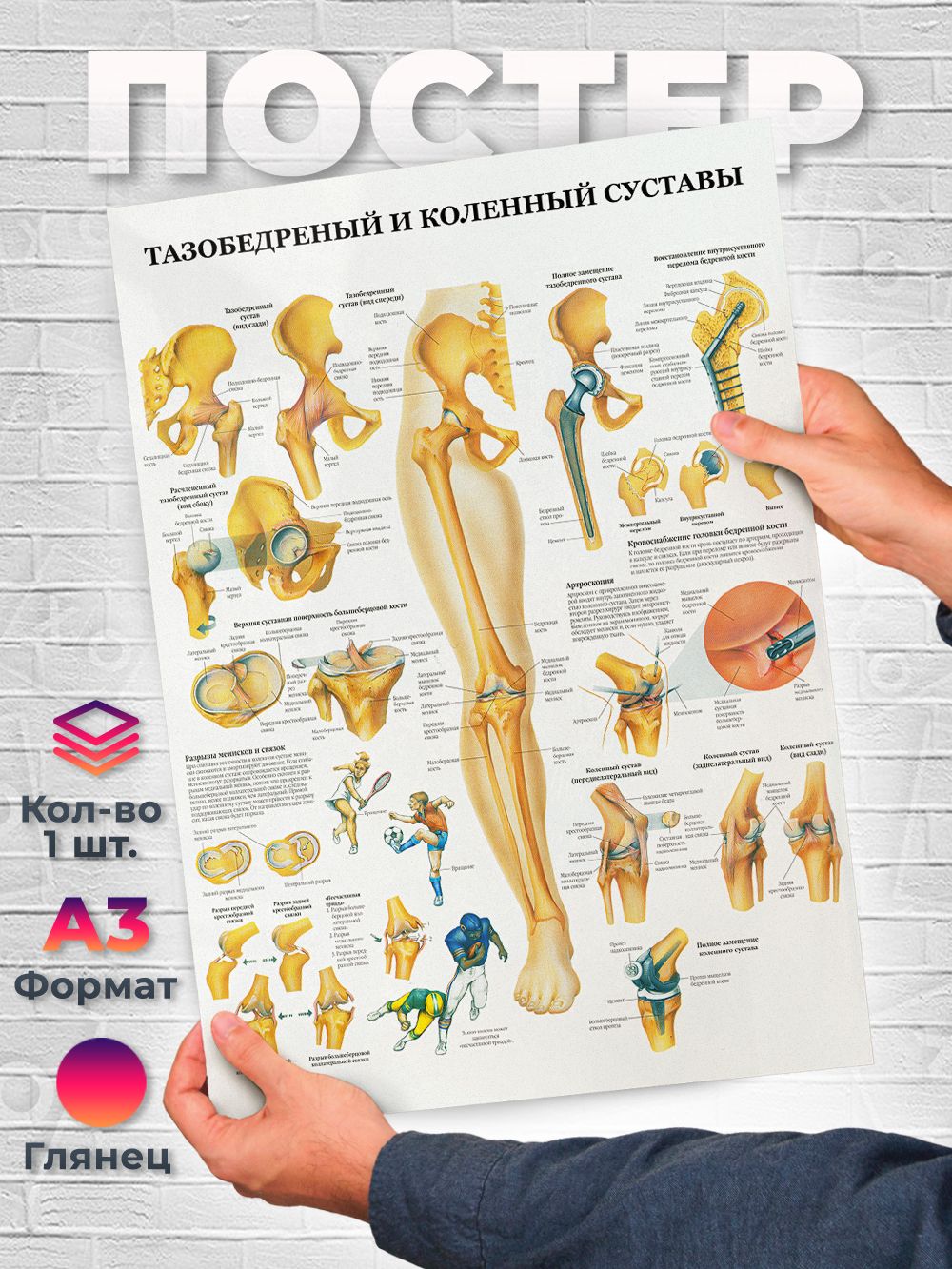 P031 Постер Суставы человека: тазобедренный и коленный