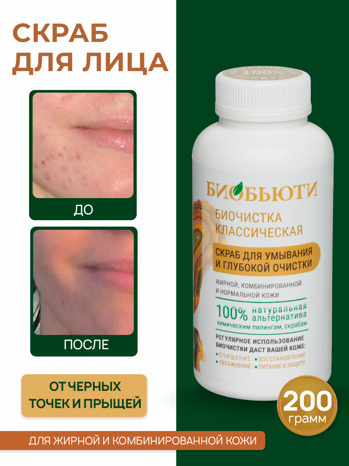 Скраб для лица от прыщей и черных точек для жирной, комбинированной и нормальной кожи "Биочистка классическая", 200 г