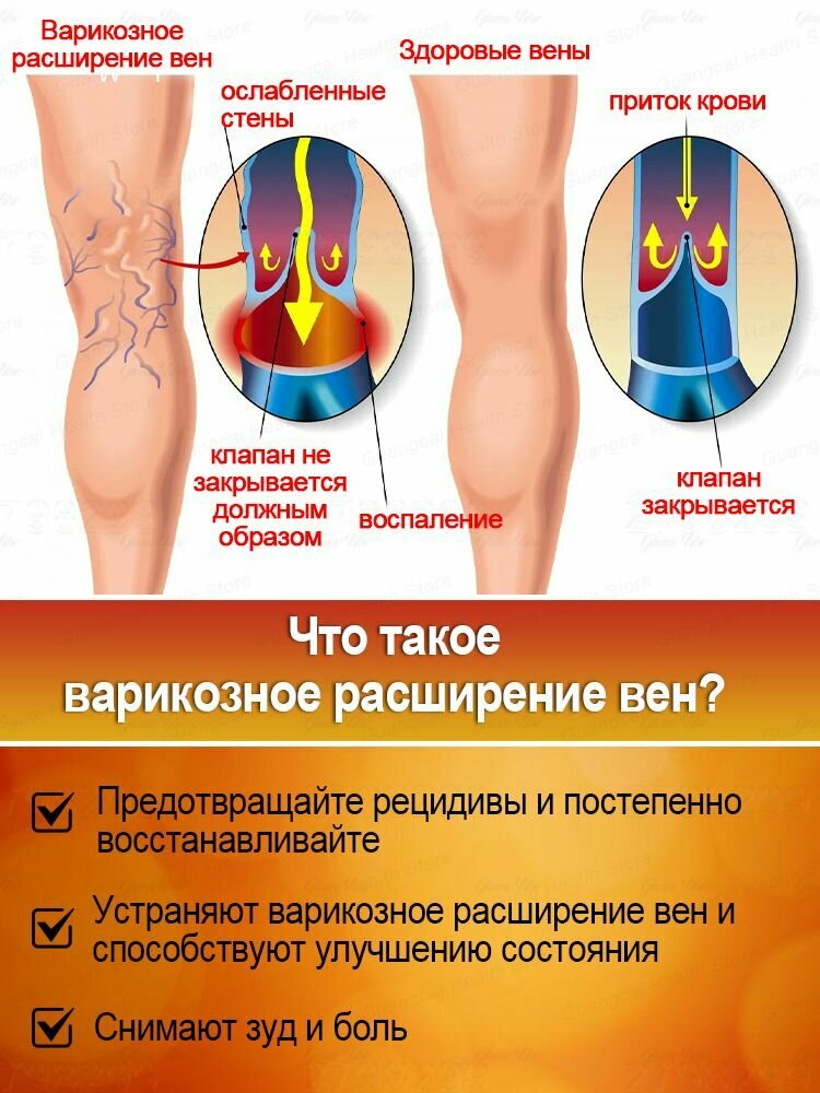 Лазерная ручка для лечения варикозного расширения вен, отёков и тяжести в ногах, сосудистых ангиом и тромбов. Эффективно очищает сосуды и обеспечивает эффективное лечение. Одна упаковка. от варикоза от отеков очищение сосудов