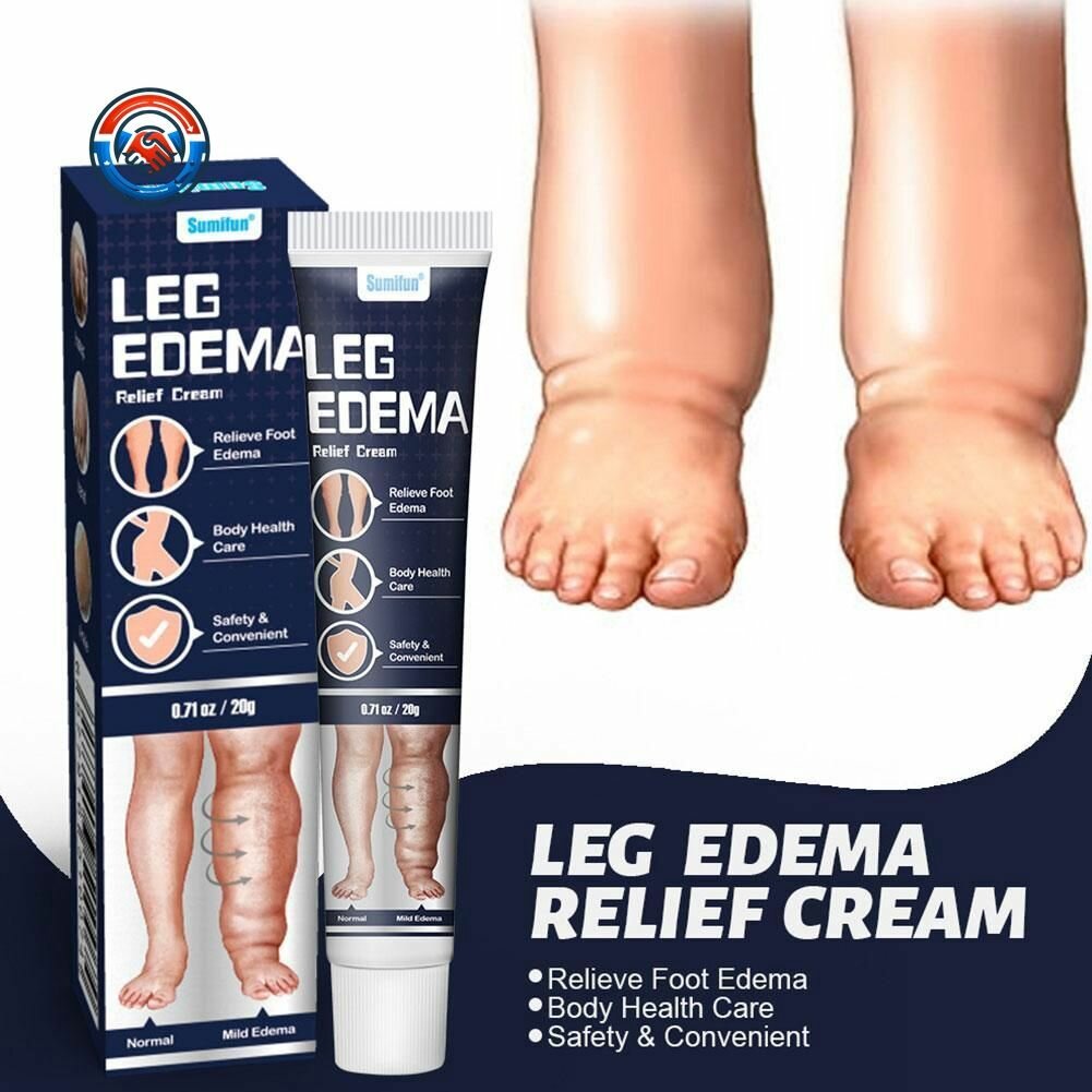 Крем от отёков ног Sumifun, быстрое снятие усталости и тяжести, натуральная формула для беременных и пожилых, портативный тюбик 20 г