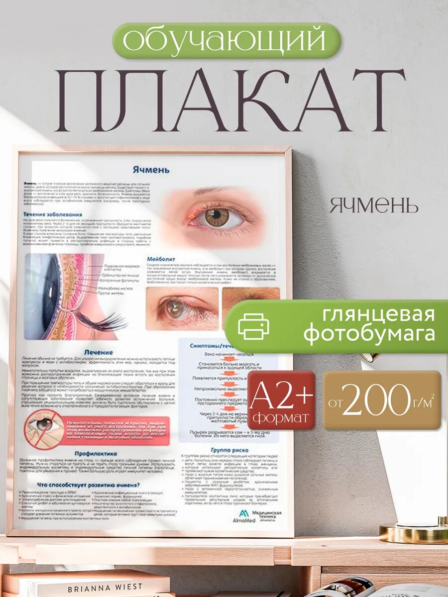 Ячмень медицинский плакат, глянцевая фотобумага от 200 г/кв. м, размер A2+
