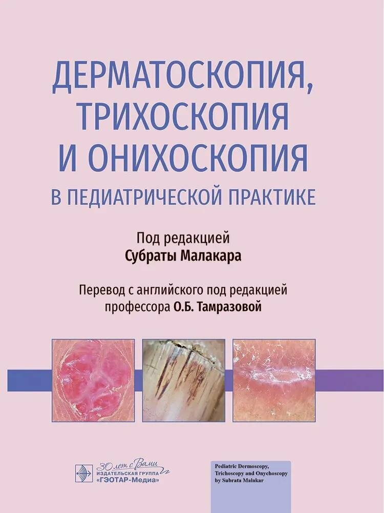 Книга гэотар-медиа Дерматоскопия, трихоскопия и онихоскопия в педиатрической практике. Малакара С, 2024