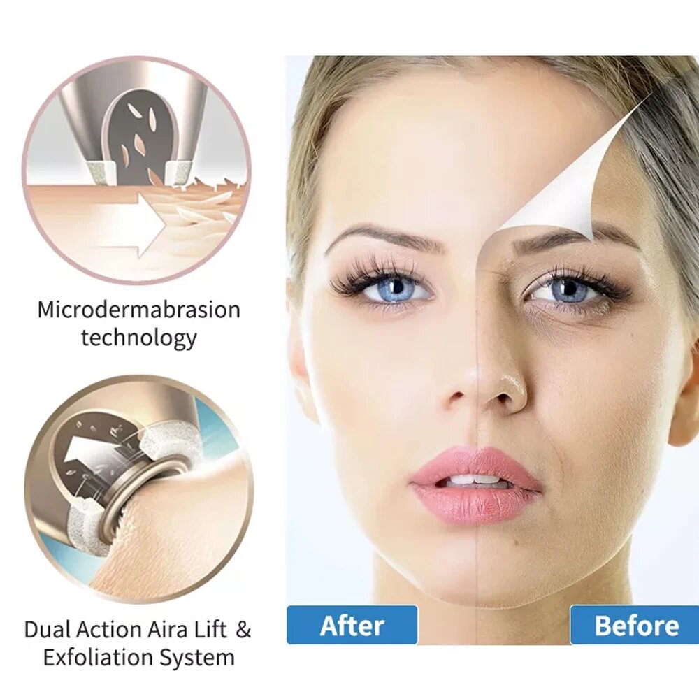 Wireless Diamond Microdermabrasion Machine для лица — фото 1