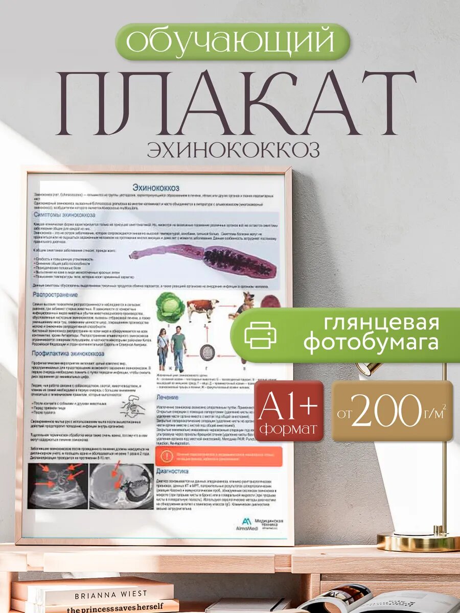 Эхинококкоз медицинский плакат глянцевая фотобумага от 200 г/кв. м, размер A1+