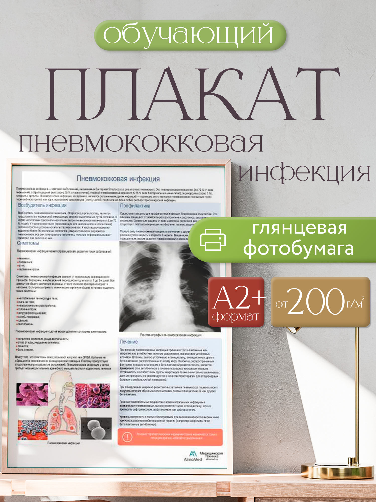 Пневмококковая инфекция медицинский плакат глянцевая фотобумага от 200 г/кв. м, размер A2+