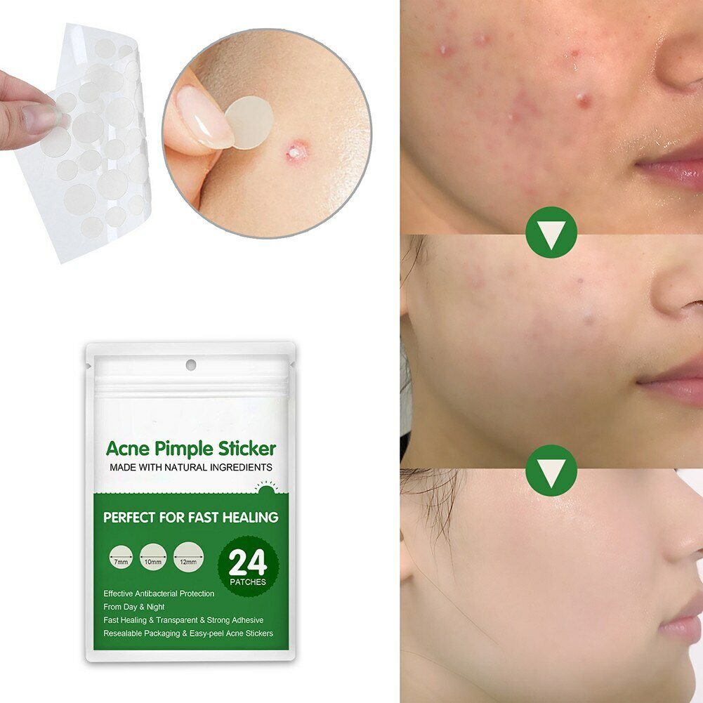 24/36 шт, наклейки для пластырей от прыщей, инструменты для красоты, набор пластырей от прыщей, средство для удаления меток, гидроколлоидный пластырь для лица, уход за кожей лица