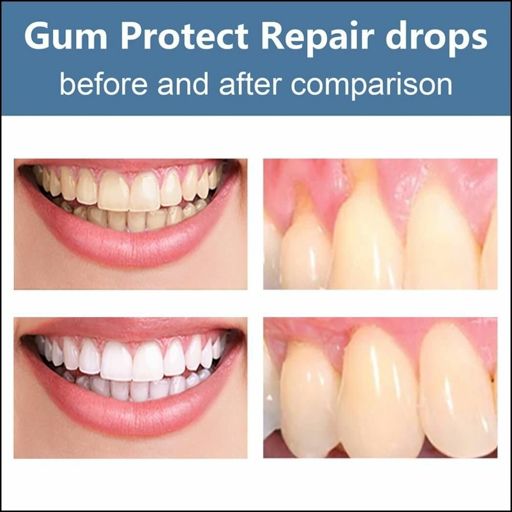 30 мл капли-сыворотки для восстановления десен облегчают рецессию
