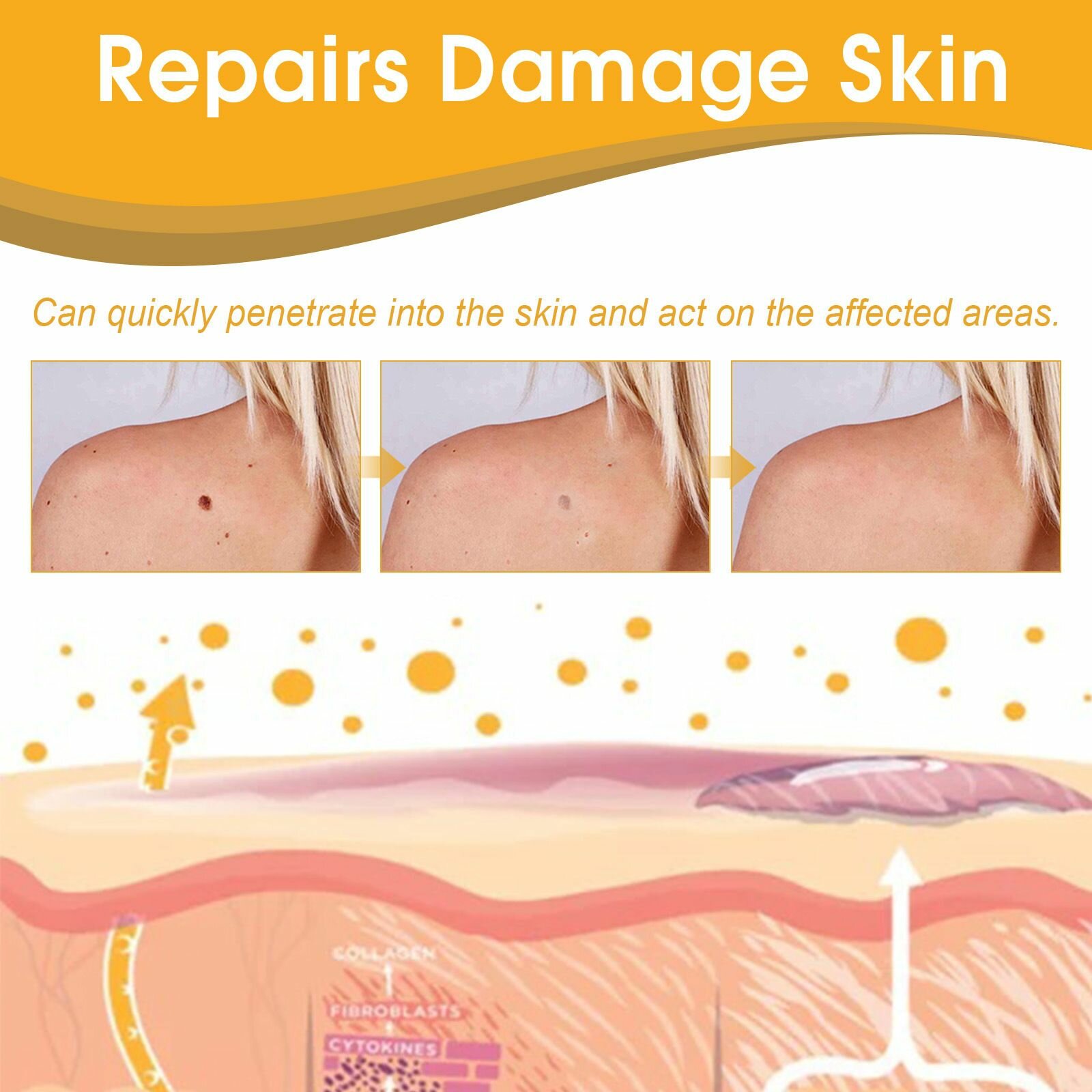 60ML Tag Recede Bee Venom, Средство от папиллом и бородавок, мазь для ухода за кожей 60 мл