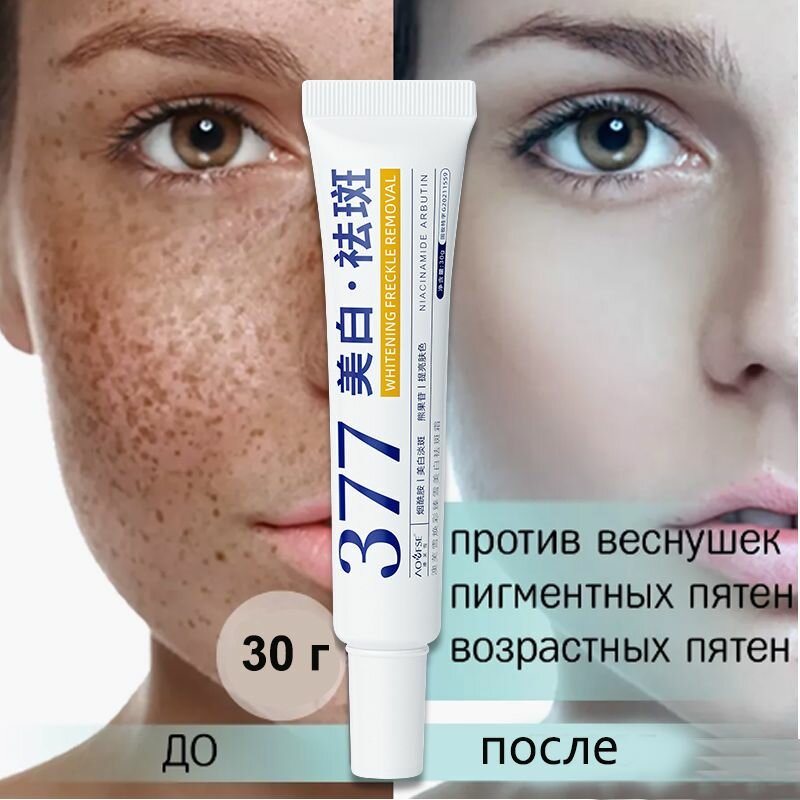 Крем для отбеливания и удаления веснушеk,30g, для удаления веснушек, пигментных пятен, мелазмы, для комплексного ухода кожи, осветляющий скрывает