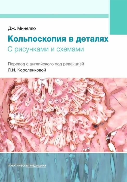 Кольпоскопия в деталях с рисунками и схемами. Минелло. 2024г.