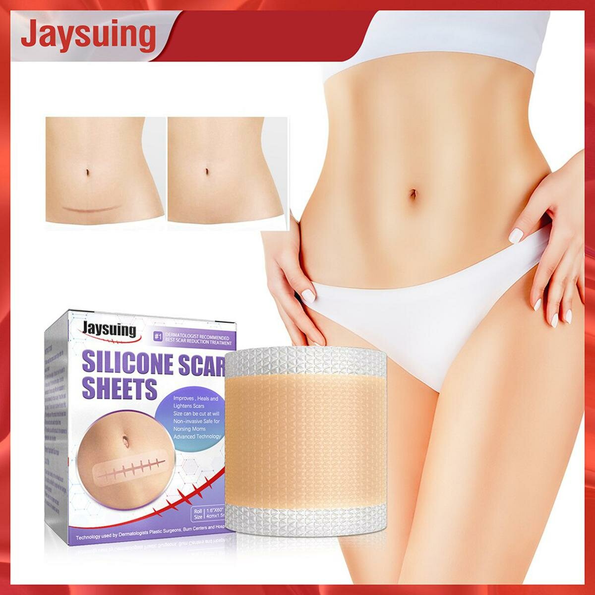 Высокоэффективные косметические силиконовые самоклеящиеся пластыри для удаления рубцов от угревой сыпи, ожогов, шрамов, ролики 4x150 см