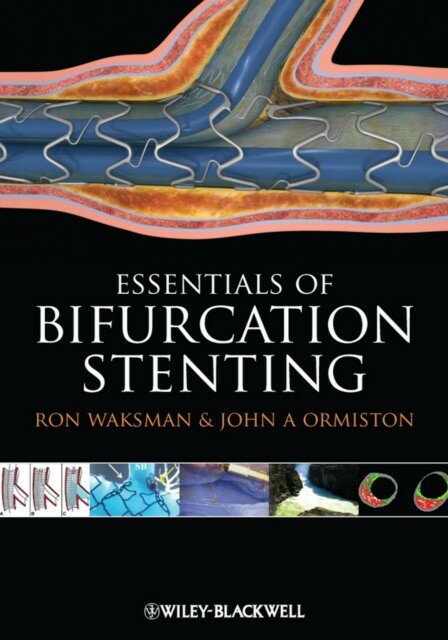 Waksman "Essentials of Bifurcation Stenting"