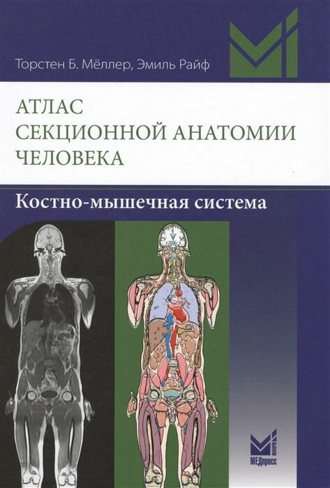 Атлас секционной анатомии человека. Костно-мышечная система. Торстен Б. Меллер