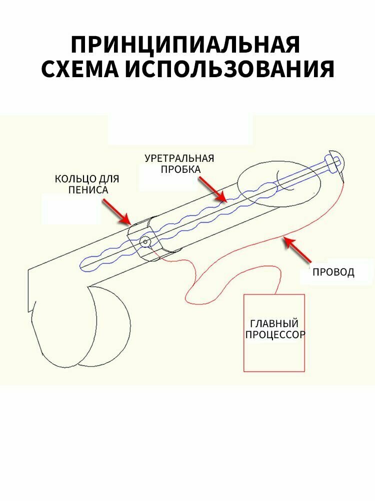 Электростимуляторы — фото 1