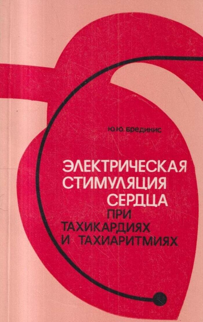 Электрическая стимуляция сердца при тахикардиях и тахиаритмиях