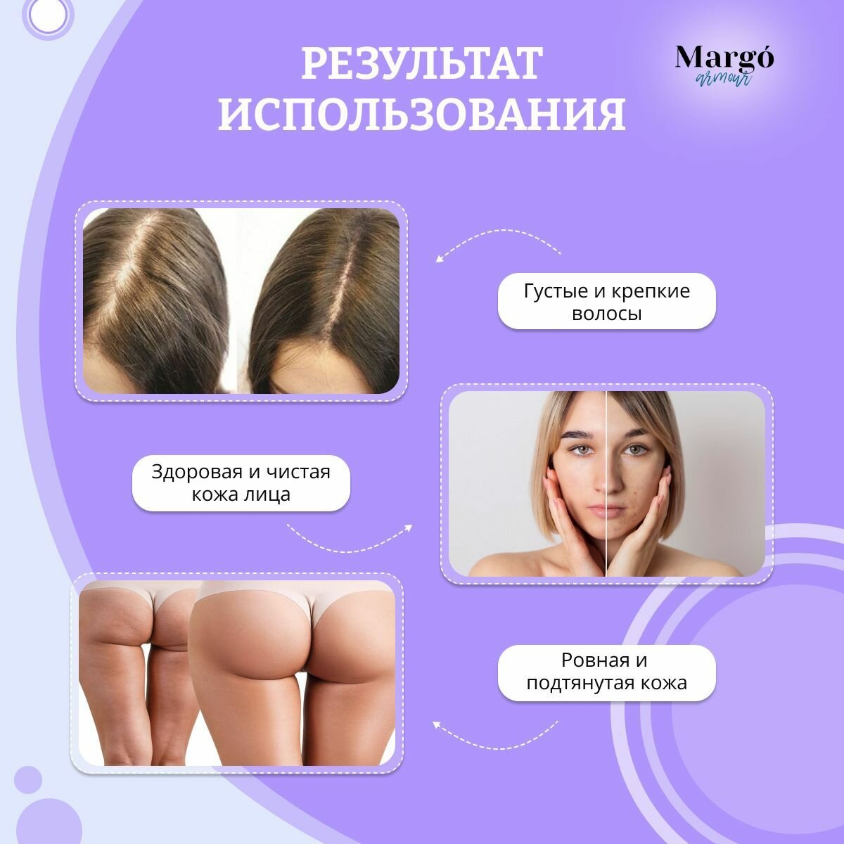 Margoarmor Дарсонваль 7 насадок — фото 1