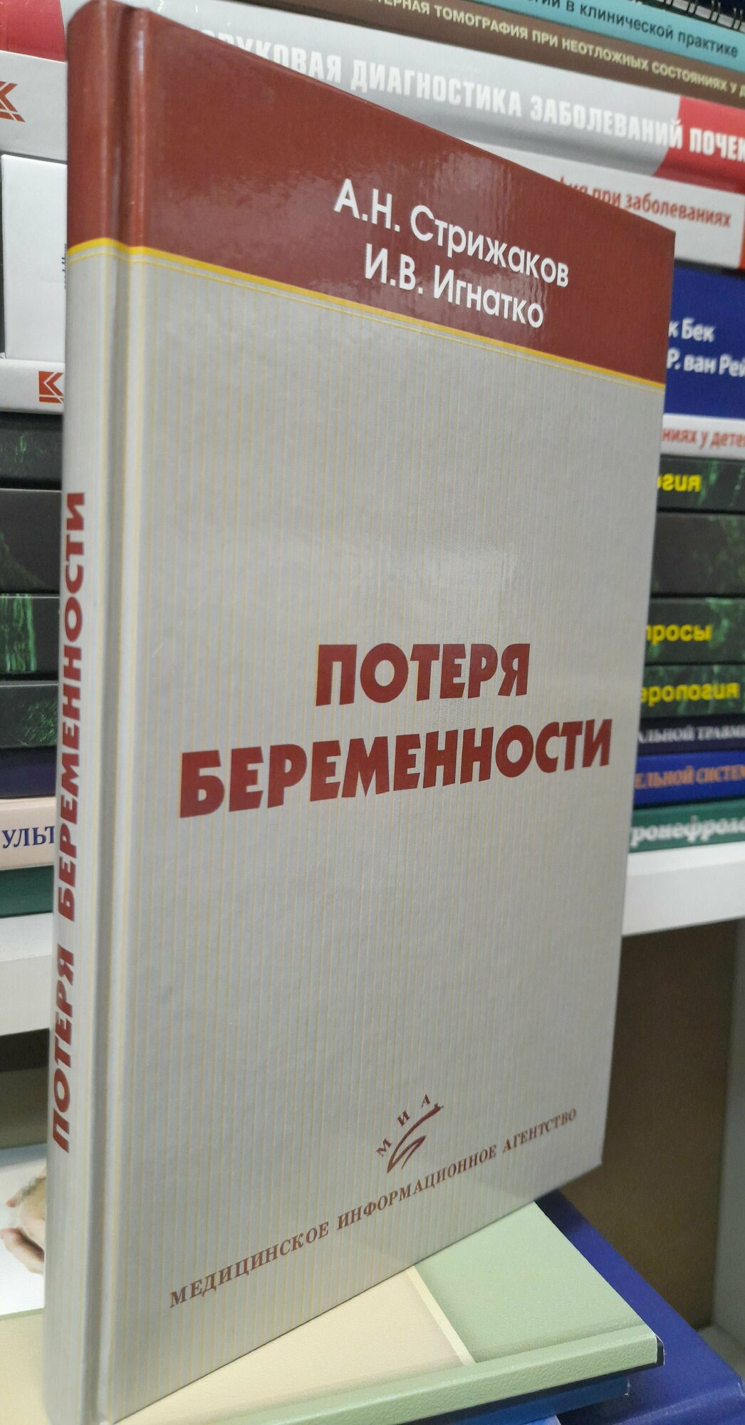 Потеря беременности — фото 1