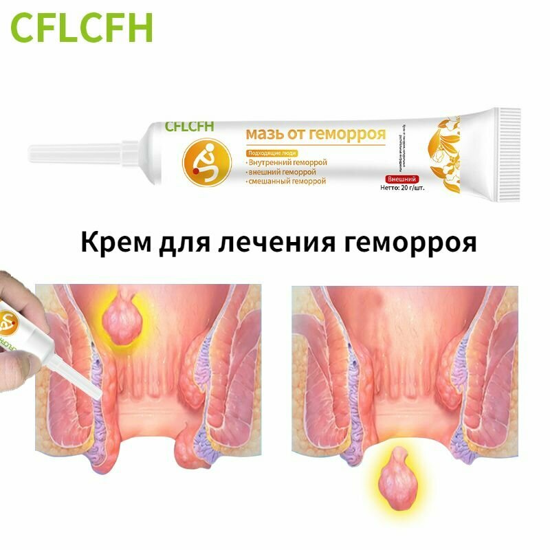 Русский травяной Крем от геморроя Натуротека мазь от боли, зуда, воспаления, трещин,20 г