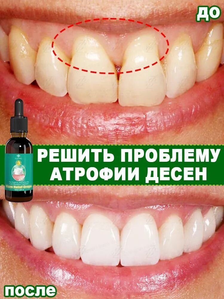 POZOAMIS-8Y Ополаскиватель для полости рта 90 мл