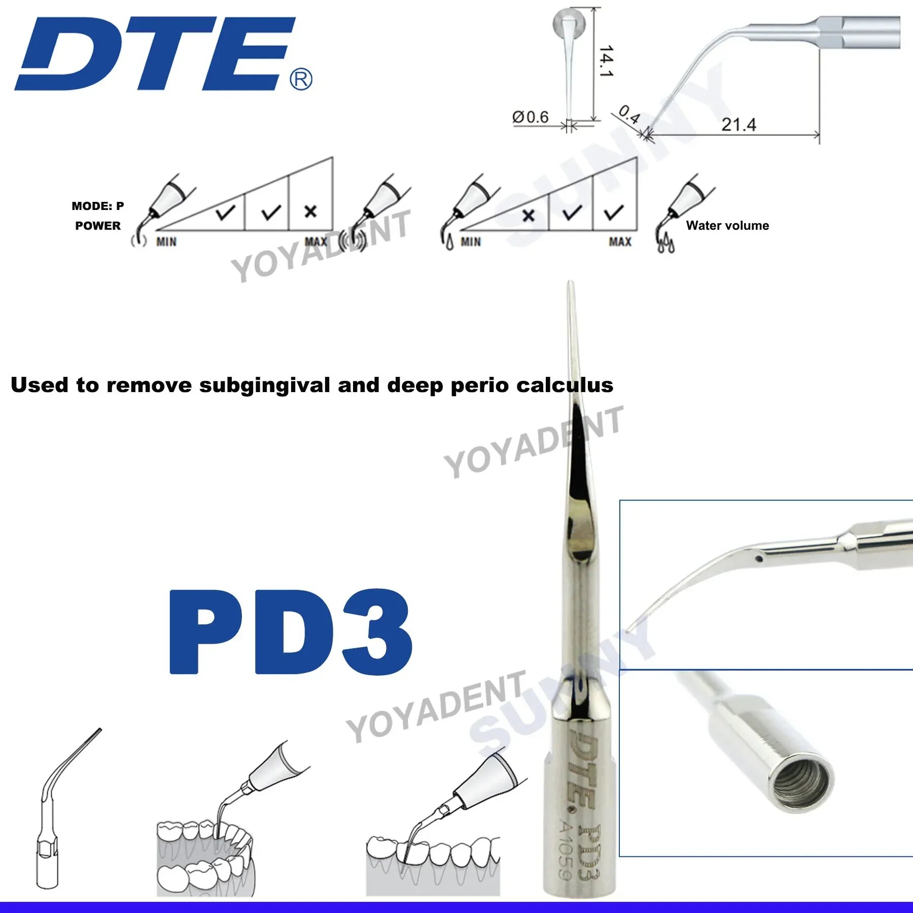 Насадки для ультразвукового скалера Woodpecker DTE PD3