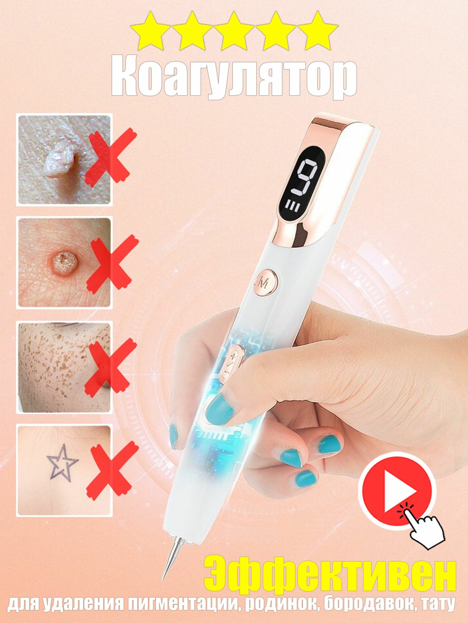 Лазерная ручка для удаления папиллом и бородавок, плазменный коагулятор против родинок и пигментации. Косметологический аппарат для коррекции татуировок и черных точек. Домашний электрокоагулятор