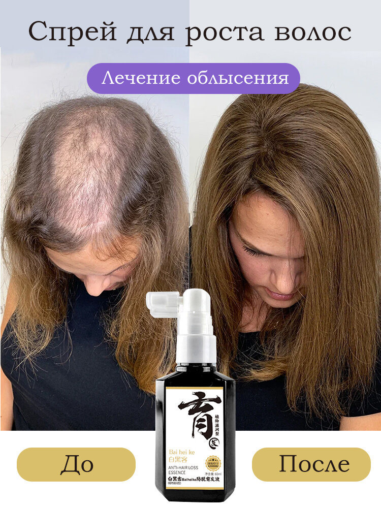 Спрей-сыворотка для роста волос, Восстановление корней волос, лечение облысения на макушке 60 мл