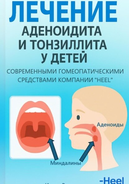Лечение аденоидита и тонзиллита у детей современными комплексными гомеопатическими препаратами фирмы «Хеель» [Цифровая книга]