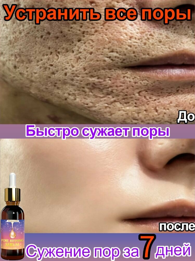 POZOAMIS Эмульсия для ухода за кожей Антивозрастной уход, 30 мл