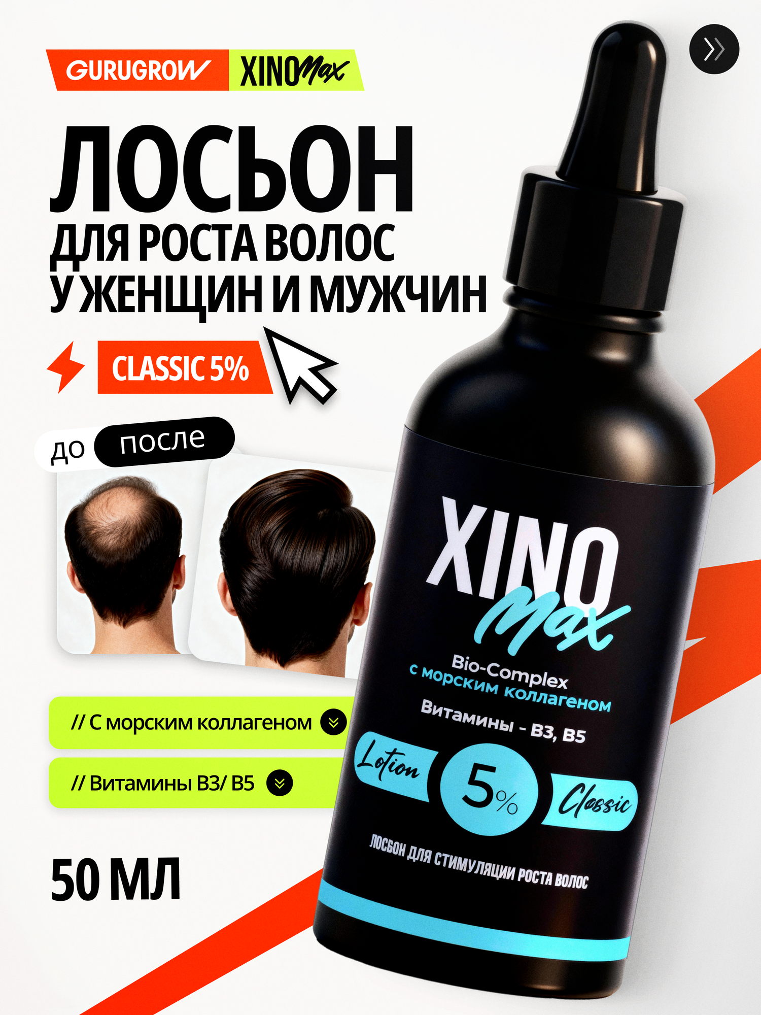 Лосьон для активации роста волос и против выпадения Xinomax 5%, с морским коллагеном, 50 мл