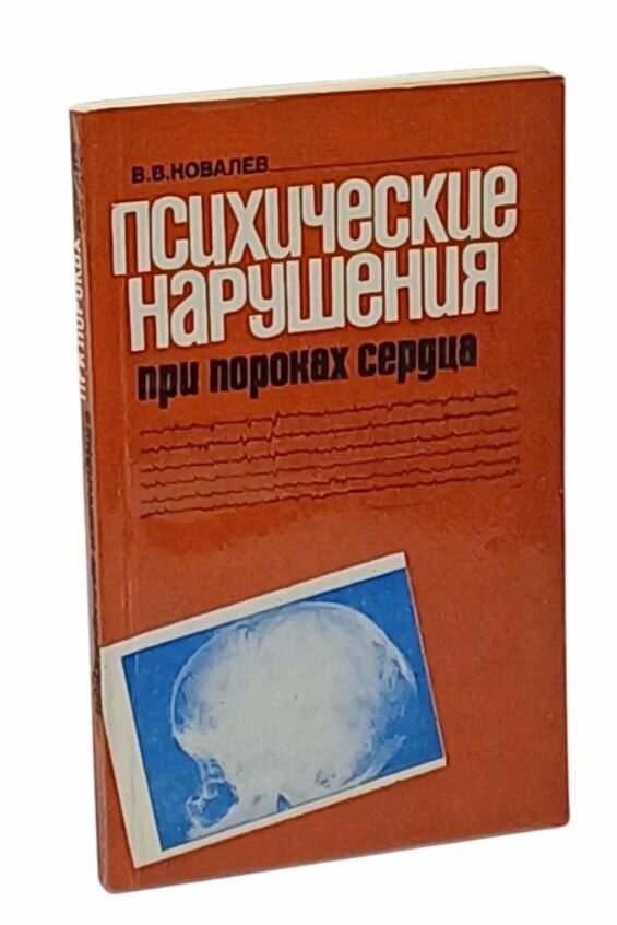 Психические нарушения при пороках сердца
