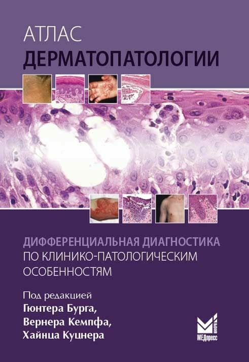 Атлас дерматопатологии. Бург
