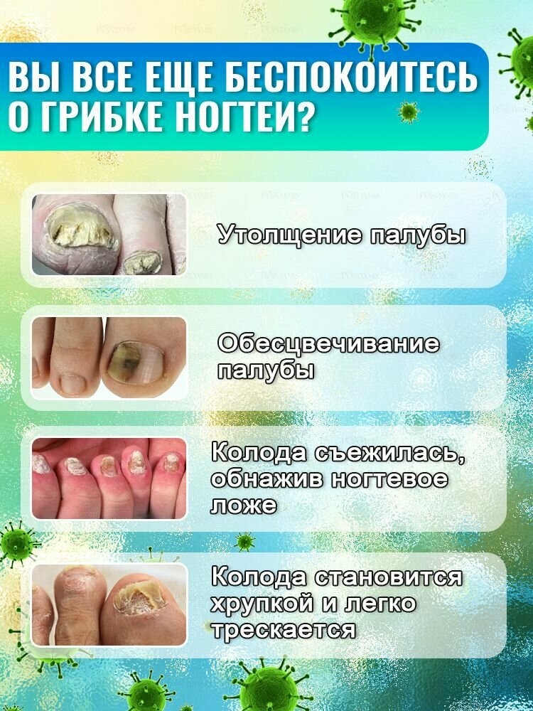 Крем для ухода за ногтями ног, восстановление ногтевой пластины, уход за поврежденными ногтями, укрепление и защита, 30 мл крем для ног восстанавливающий укрепляющий