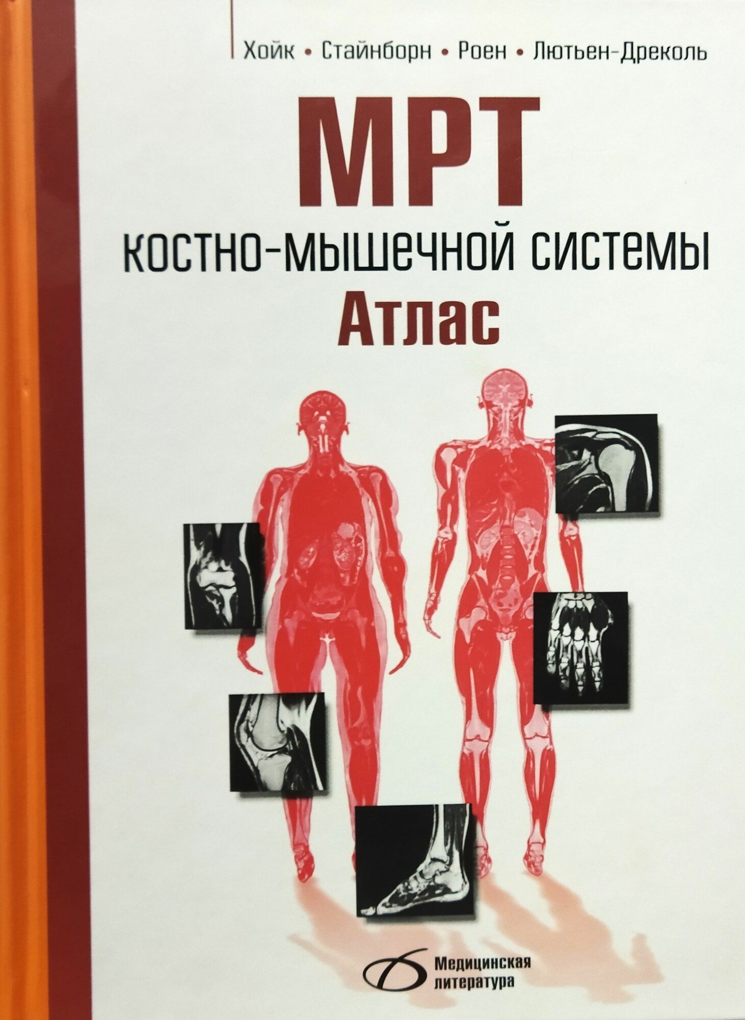 МРТ костно-мышечной системы. Атлас