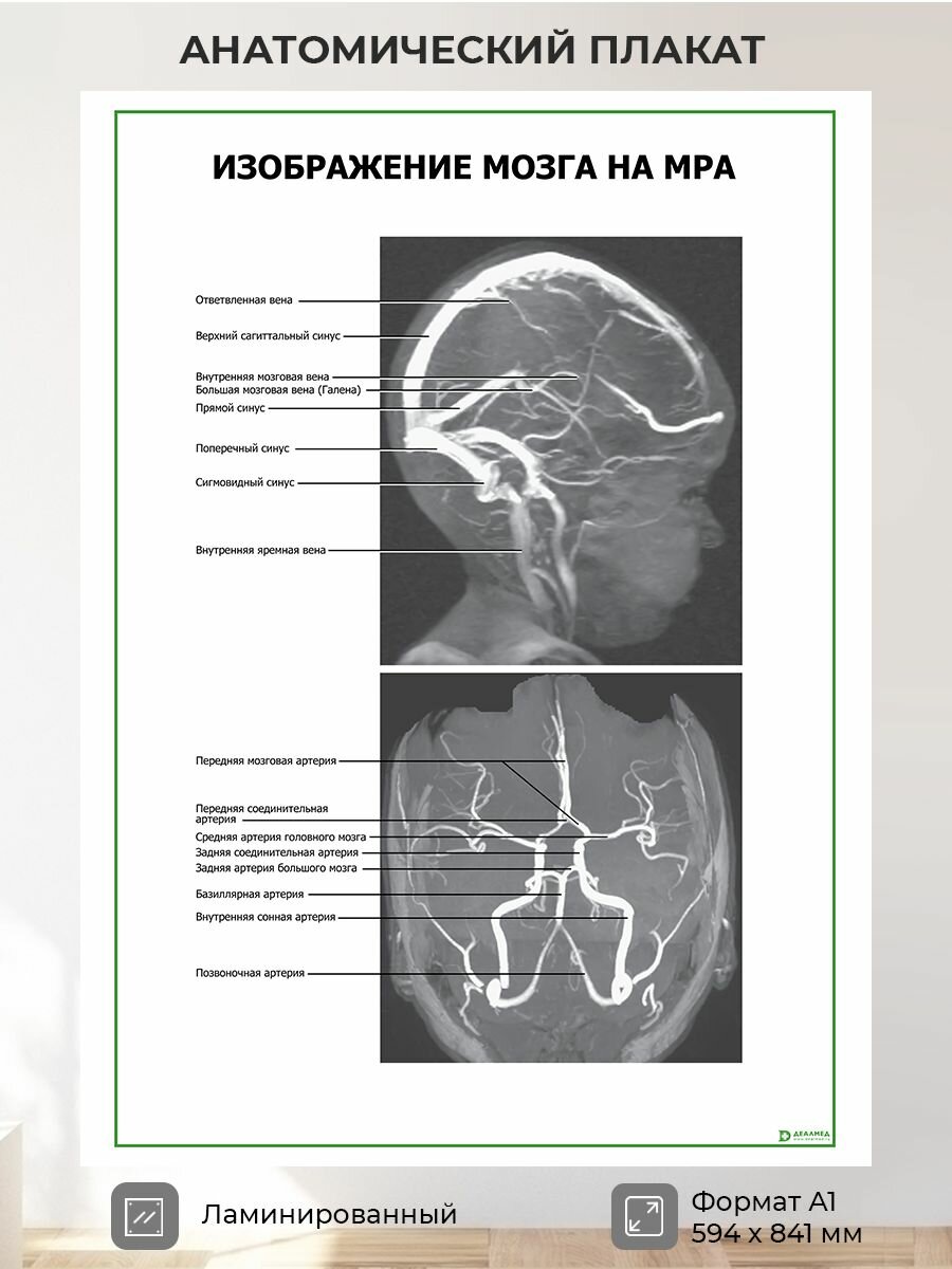 Обучающий медицинский плакат ламинированный формат А1 Изображение мозга на МРА