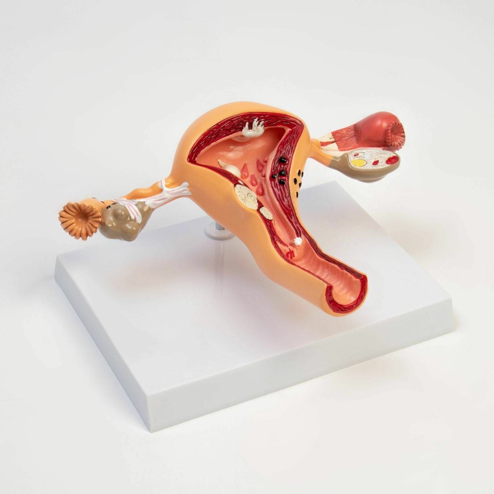 Макет "Органы матки, патологии", анатомическая 3D модель репродуктивной системы, наглядный материал для школьников и студентов, набор по биологии для исследований строения тела, 24 х 12 х 20 см