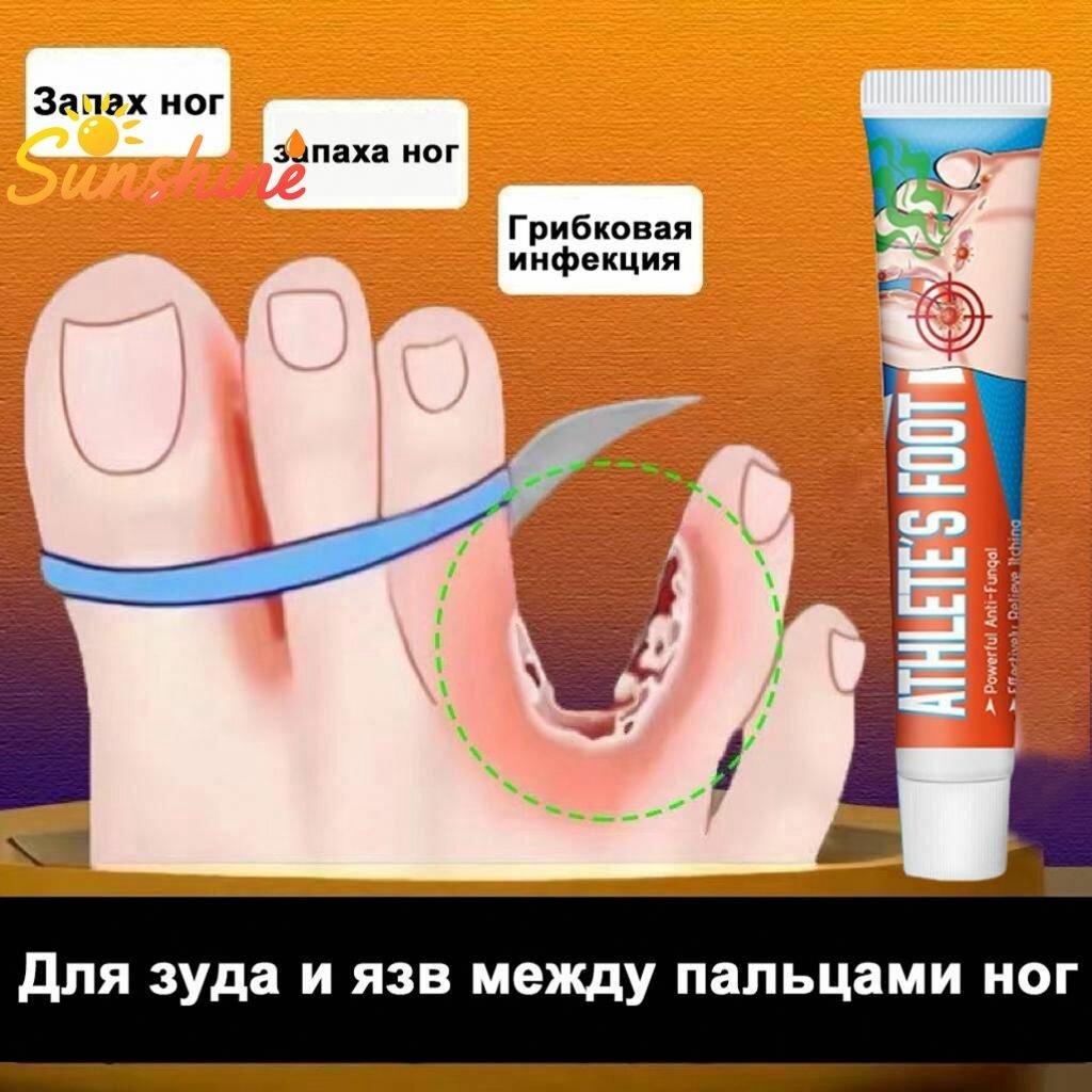 Средство от запаха ног для зуда и язв между пальцами, против грибка, дезодорант эффективное 20г