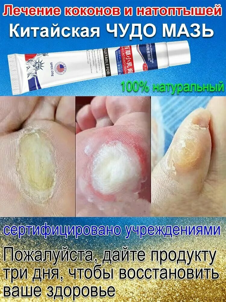 Средство от стержневых мозолей и натоптышей