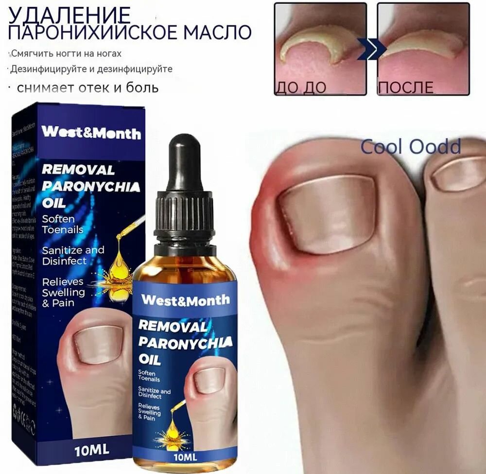 20г Вросшие ногти на ногах, для ухода за ногтями на ногах, удаляется масло паронихии