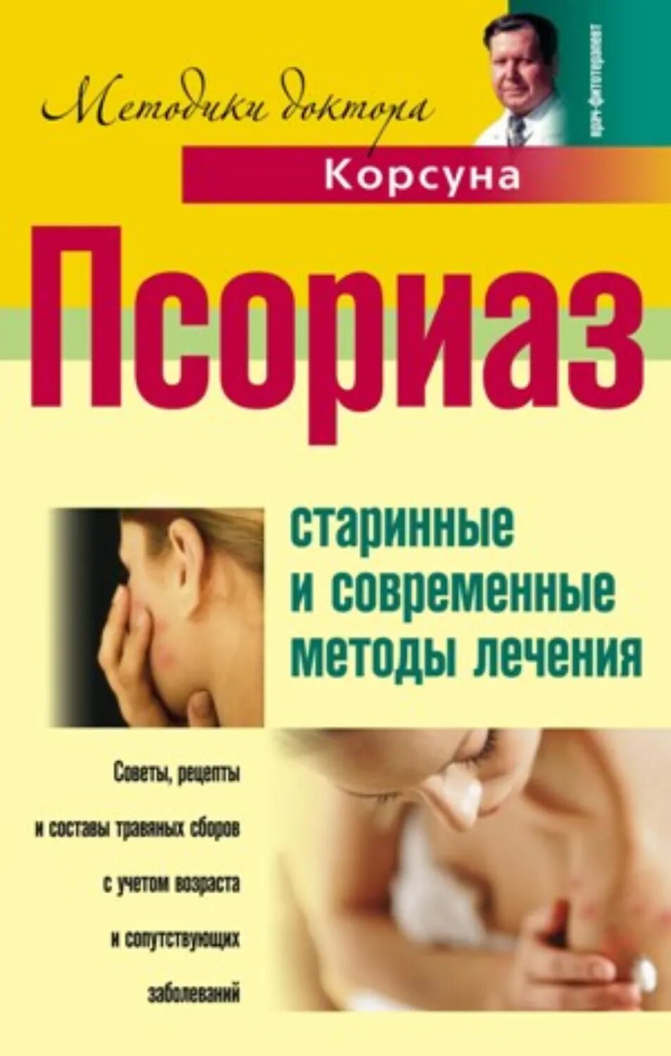 Псориаз. Старинные и современные методы лечения [Цифровая книга]