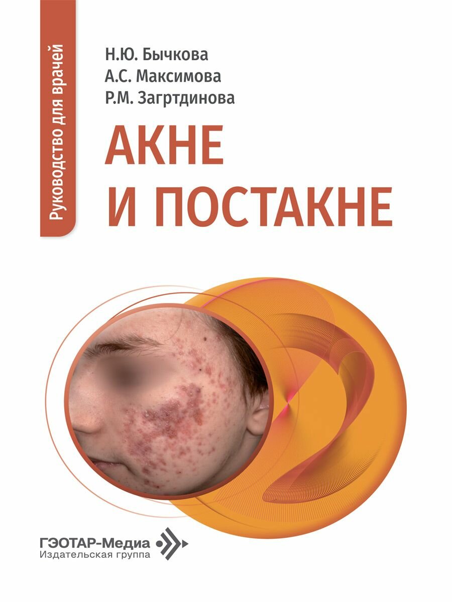 Акне и постакне. Руководство для врачей