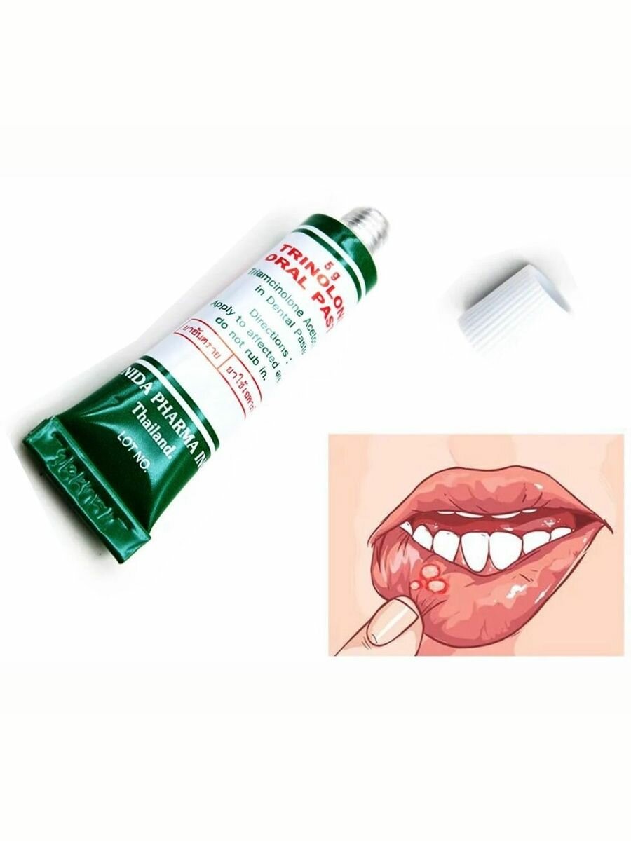 Гель-мазь нида с тринолоном для лечения заболеваний полости рта