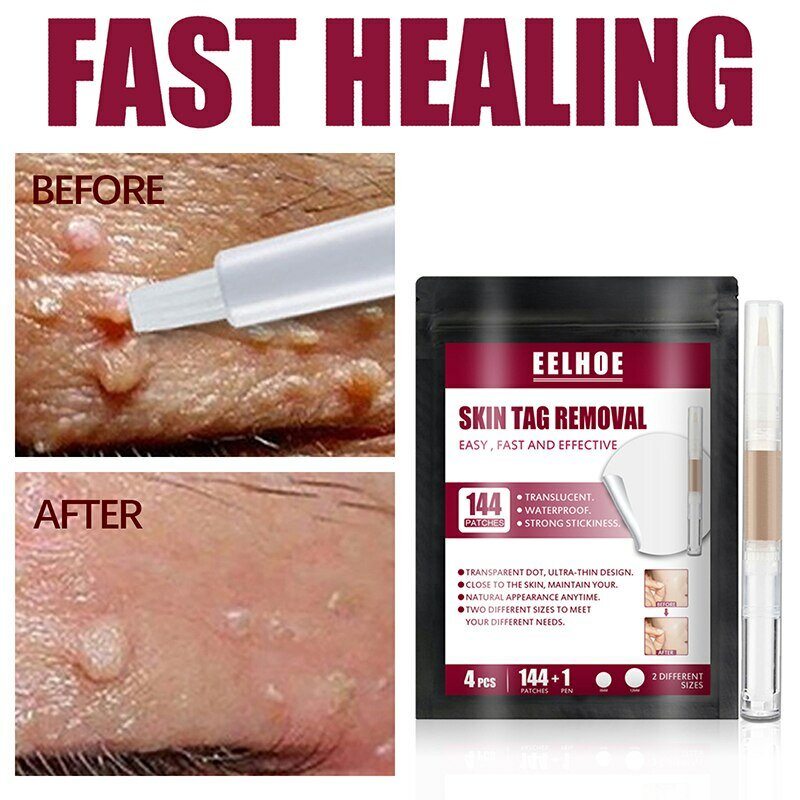 144 штуки невидимых пластырей от прыщей, крем для лечения родинок, невидимые пластыри от прыщей и черных точек