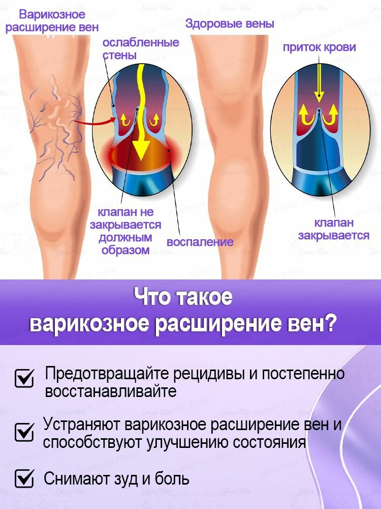 Лазерное лечение варикозного расширения вен. Снимет усталость ног. Эффективно и быстро устраняет сосудистые звездочки, тромбы и отеки ног. Нежный и не вызывающий раздражения, не оставляющий шрамов.