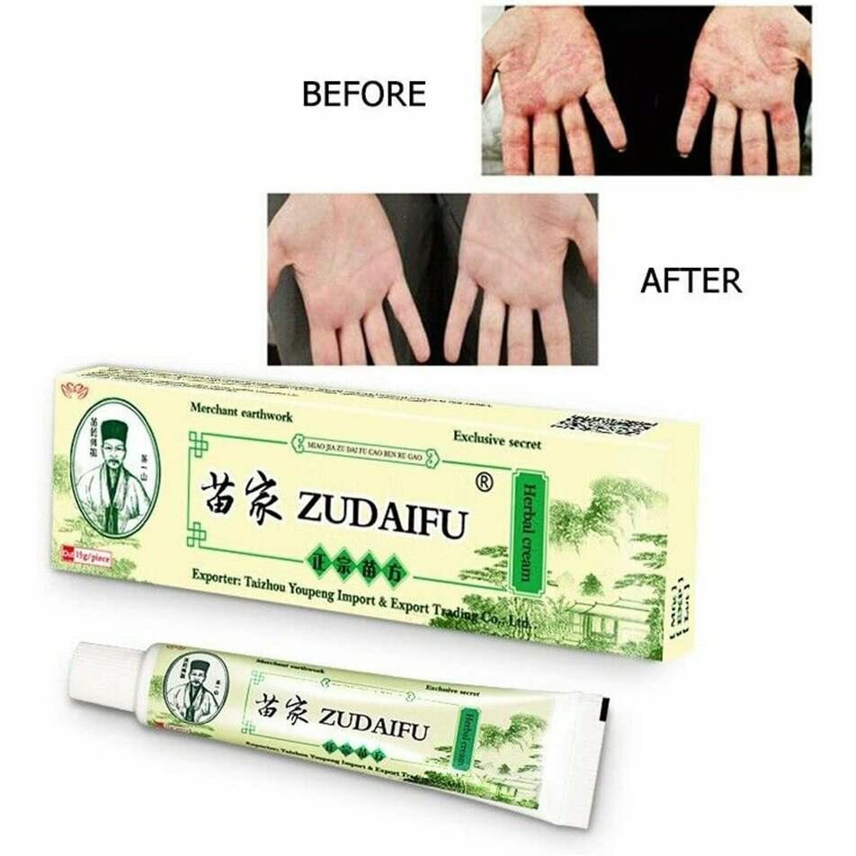 ZUDAIFU мазь от псориаза, экземы, дерматита, зуда, потницы, грибка, лишая (Зудайфу) 15гр. Семейный врач-A20